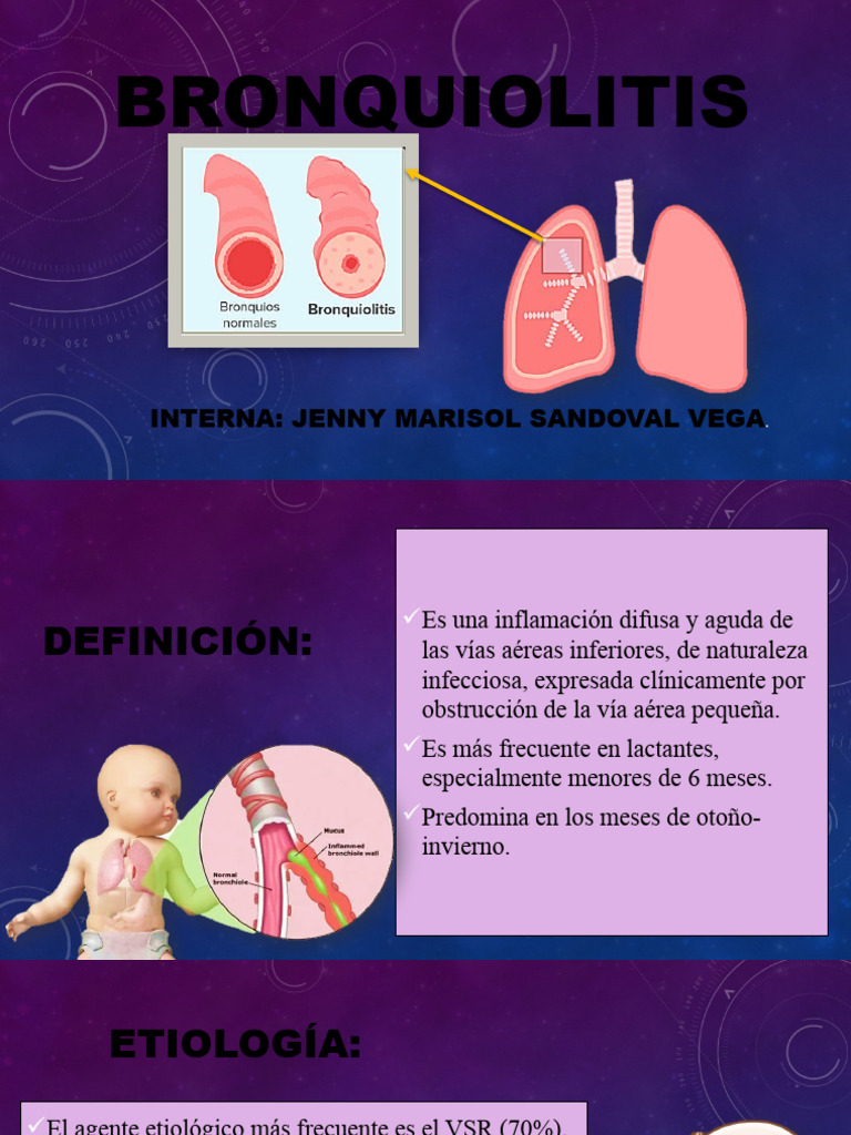 Bronquiolitis | PDF | Epidemiología | Ciencias de la Salud