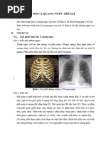 Các dấu hiệu X quang ngực | PDF