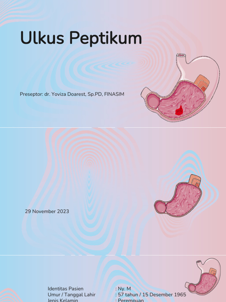Diagnosis Ulkus Peptikum pada Pasien 57 Tahun | PDF