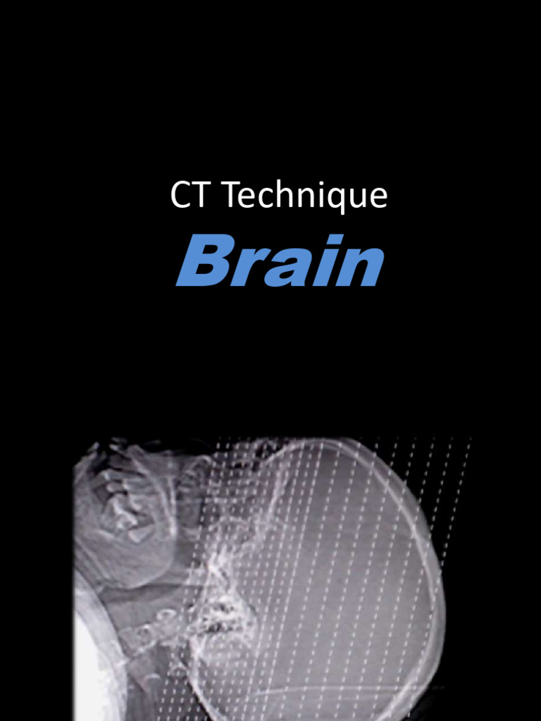3 CT Brain | Download Free PDF | Ct Scan | Magnetic Resonance Imaging