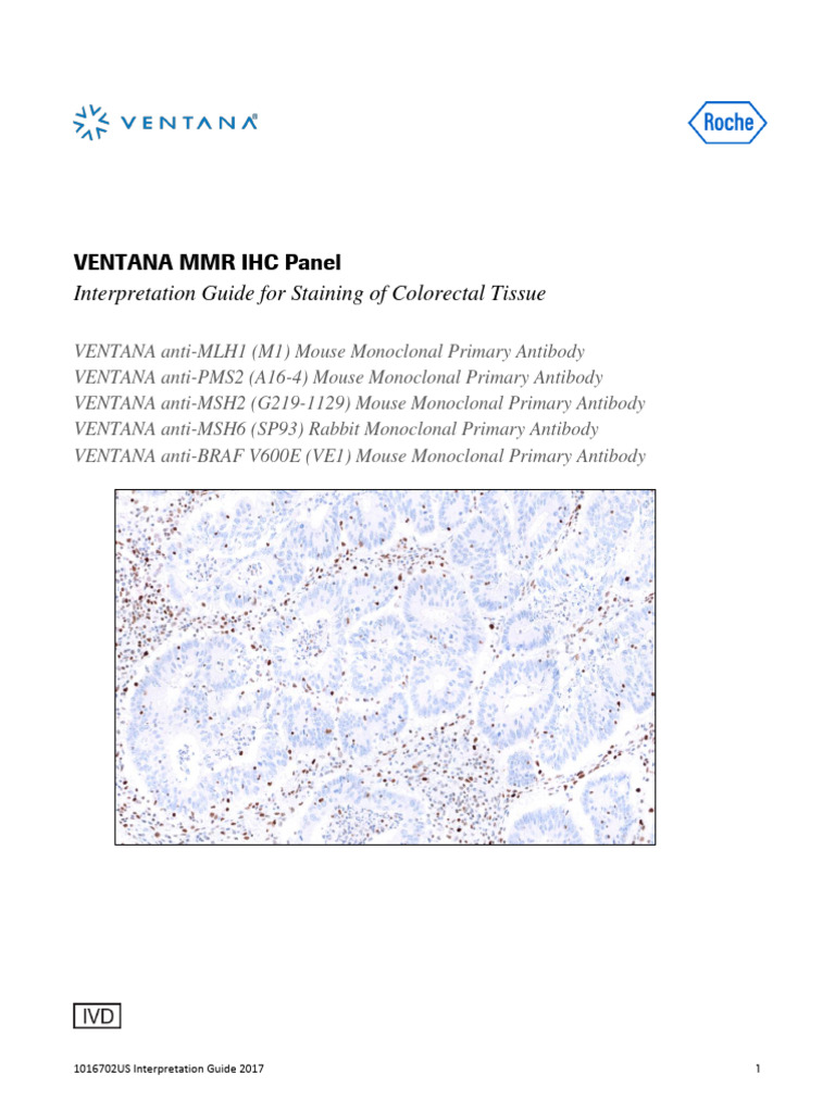 VENTANA MMR IHC Panel Guide 2017 | PDF | Immunohistochemistry ...