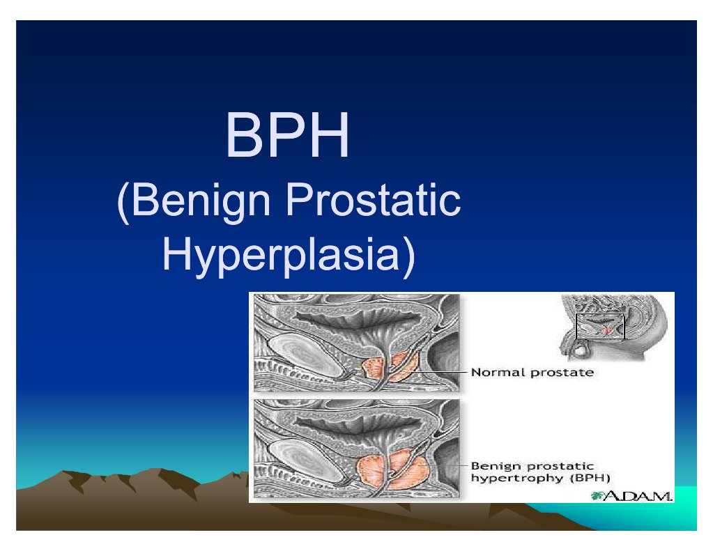 Understanding Benign Prostatic Hyperplasia: A Comprehensive Overview of ...