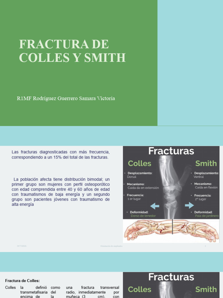 Fracturas de Colles y Smith: Comparativa | PDF | Enfermedades y ...