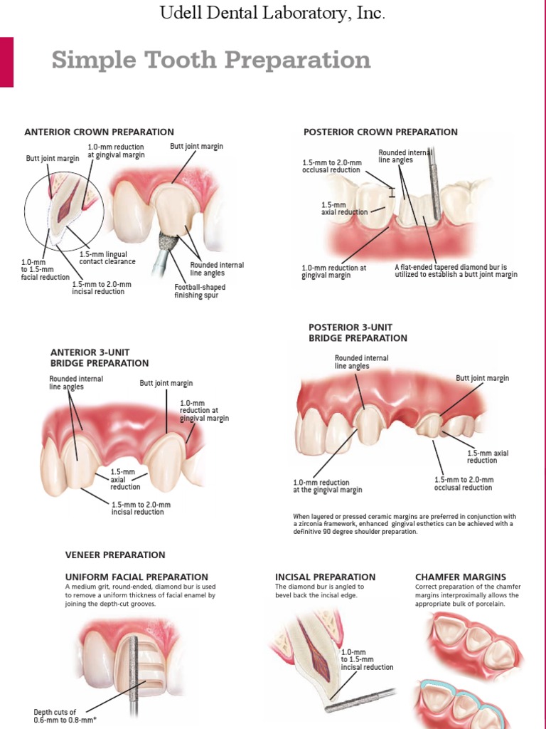 E.max Prep Guide | PDF | Dentistry Branches | Dentistry