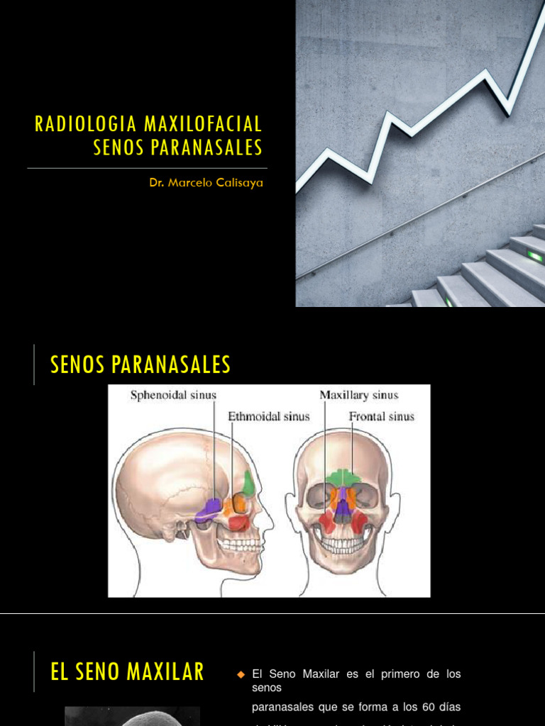 RX Senos Paranasales | PDF | Especialidades Medicas | Enfermedades y ...