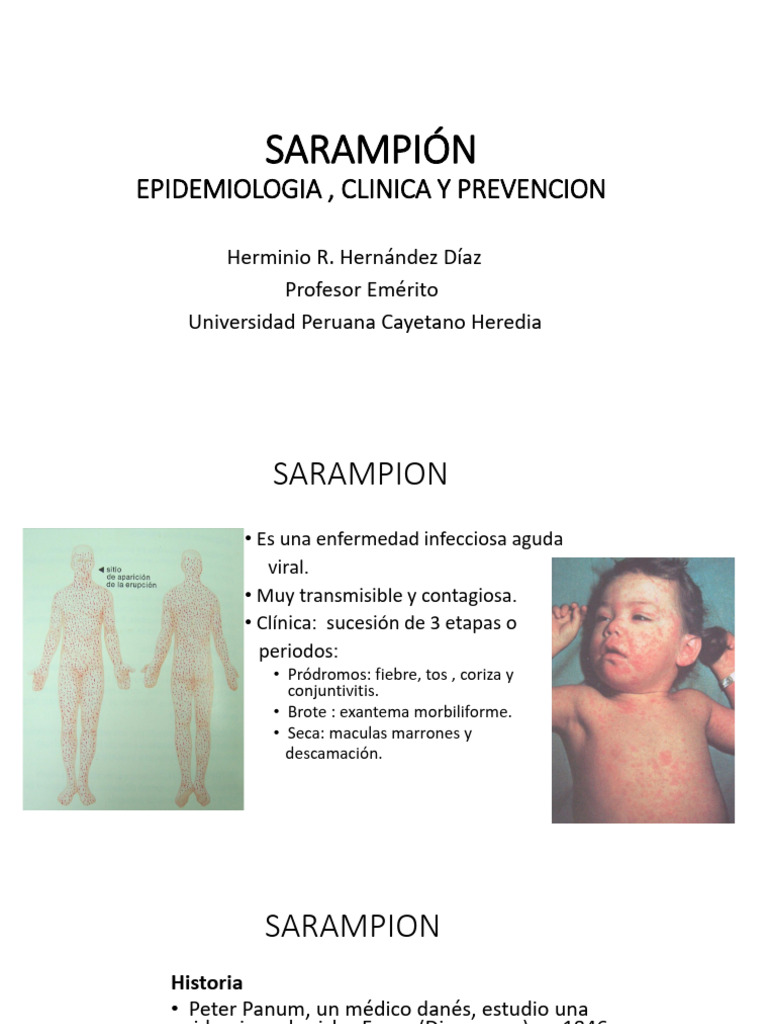 Sarampion CDC - Minsa. 12.02.2024 | PDF | Sarampión | Cuidado de la salud