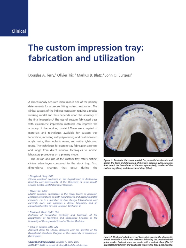 Custom Impression Tray Article | Dental Degree | Adhesive
