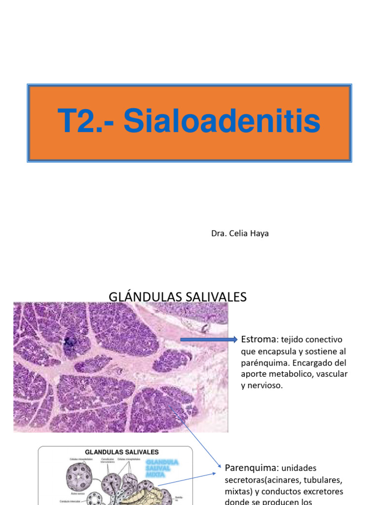 Sialoadenitis 7-2-12 | PDF | Causas de la muerte | Medicina CLINICA