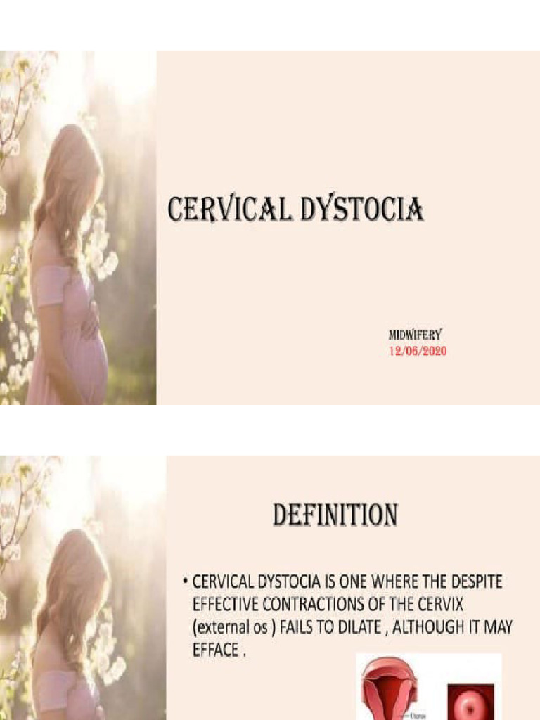 Cervical Dystocia | PDF