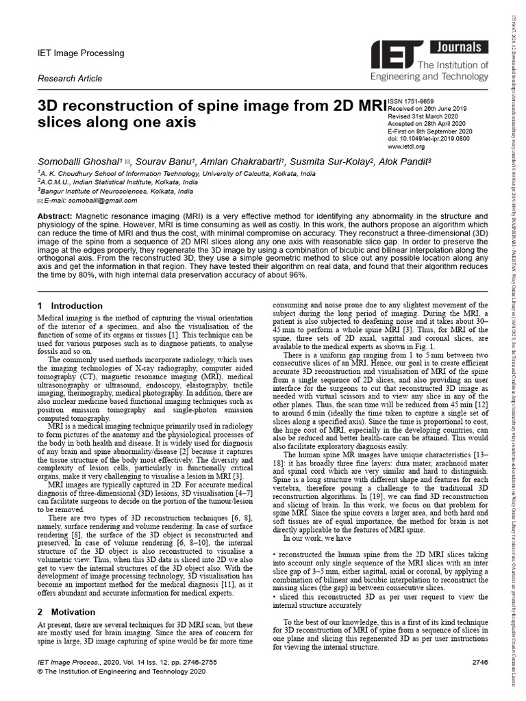 IET Image Processing - 2020 - Ghoshal - 3D Reconstruction of Spine ...