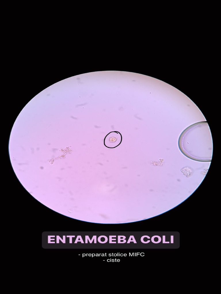 Parazitologija (Mikro) | PDF