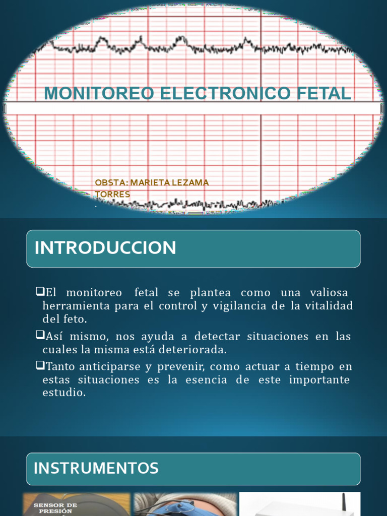 Monitoreo Electronico Fetal 2021 I | PDF | Amplitud | Embarazo humano