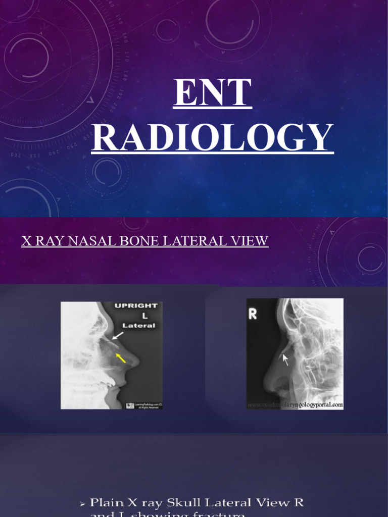 X Ray | PDF | Social Science | Foreign Language Studies