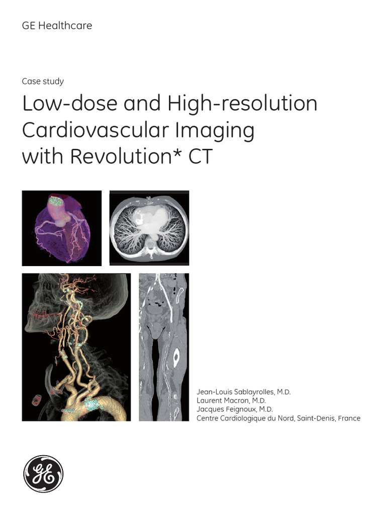 Revolution - CT-Clinical - Case - Low - Dose - CV Imaging - JB25620XXa ...