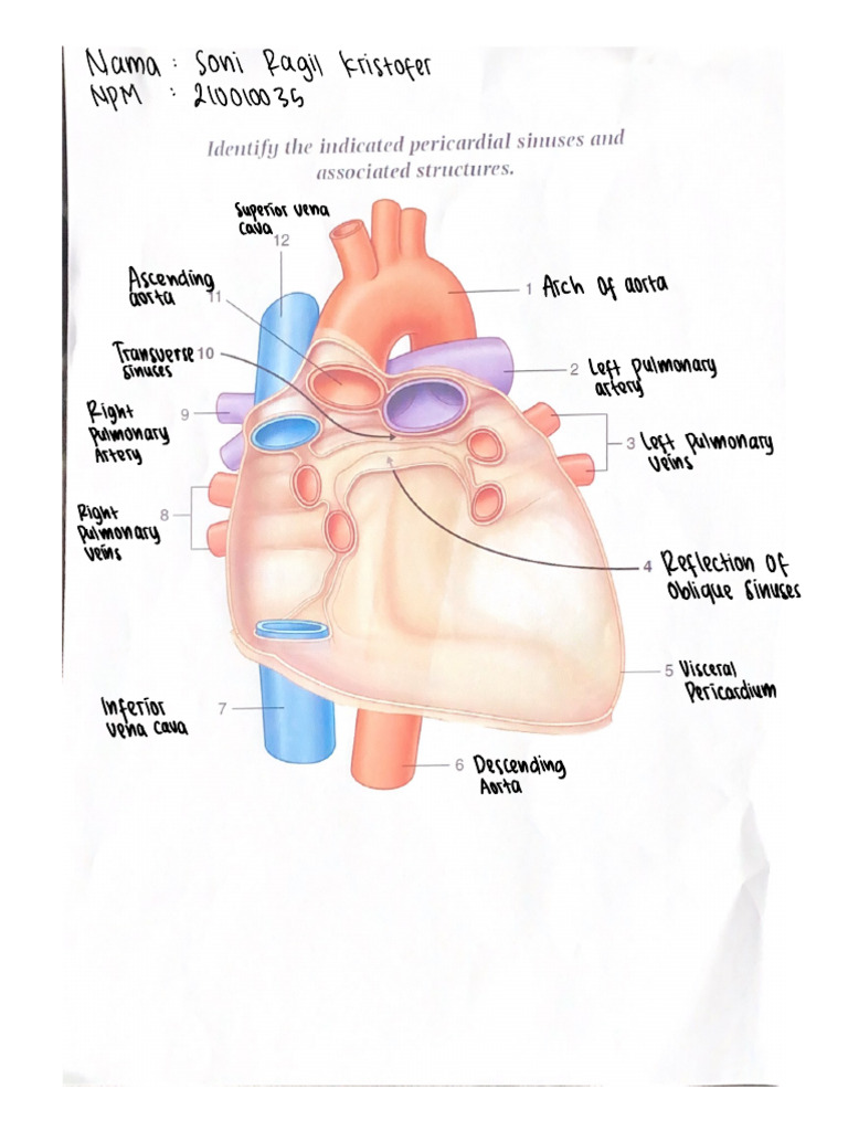 LA Anatomy STATION 2 | PDF | Aorta | Common Carotid Artery