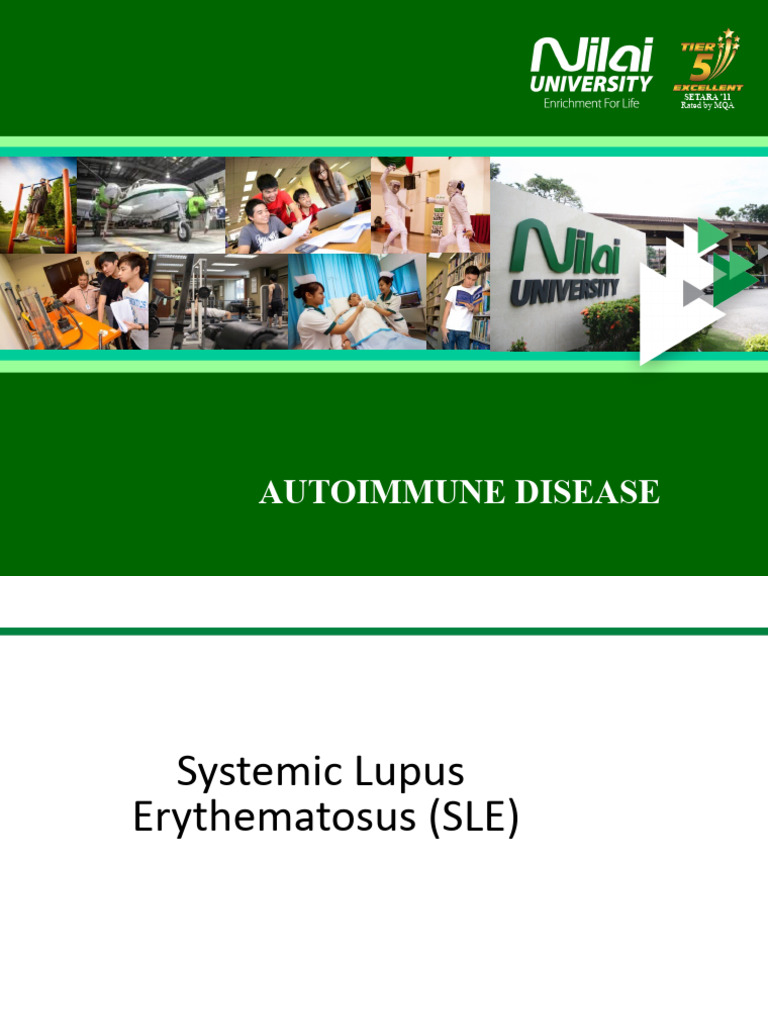 Understanding Systemic Lupus Erythematosus | PDF | Myelin | Multiple ...