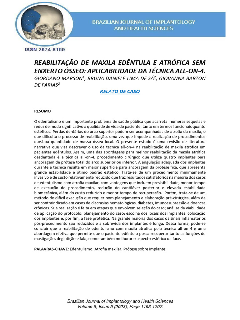 Reabilitação da Maxila Edêntula com All-on-4 | PDF | Dente humano