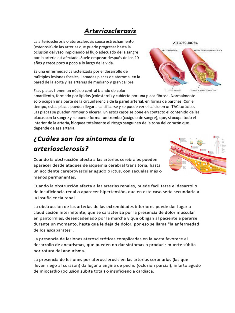 Arteriosclerosis | Descargar gratis PDF | Aterosclerosis | Medicina CLINICA