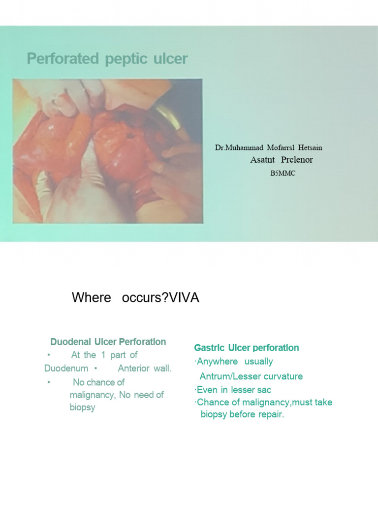 Medical VIVA: Peptic Ulcer Perforation | PDF | Digestive System | Digestive Diseases