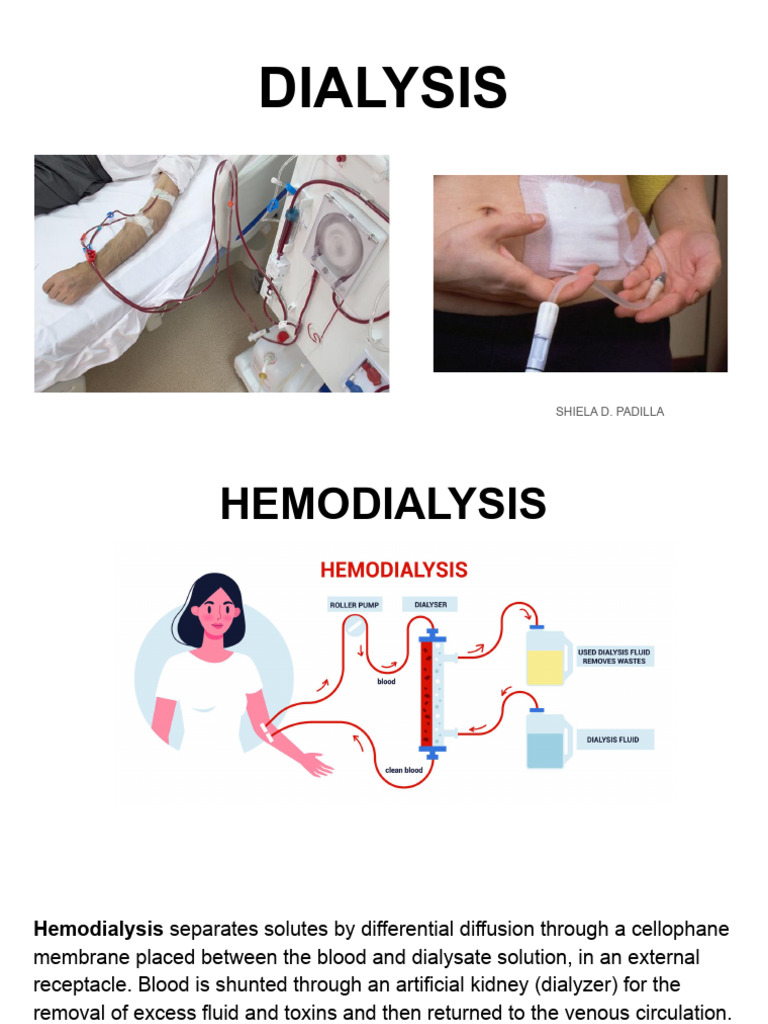 DIALYSIS | PDF | Hemodialysis | Peritoneum