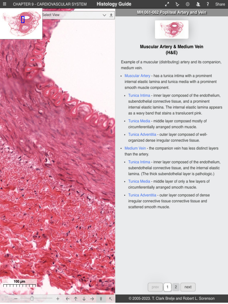 Muscular Artery and Medium Vein Cardiovascular System | PDF | Artery | Vein