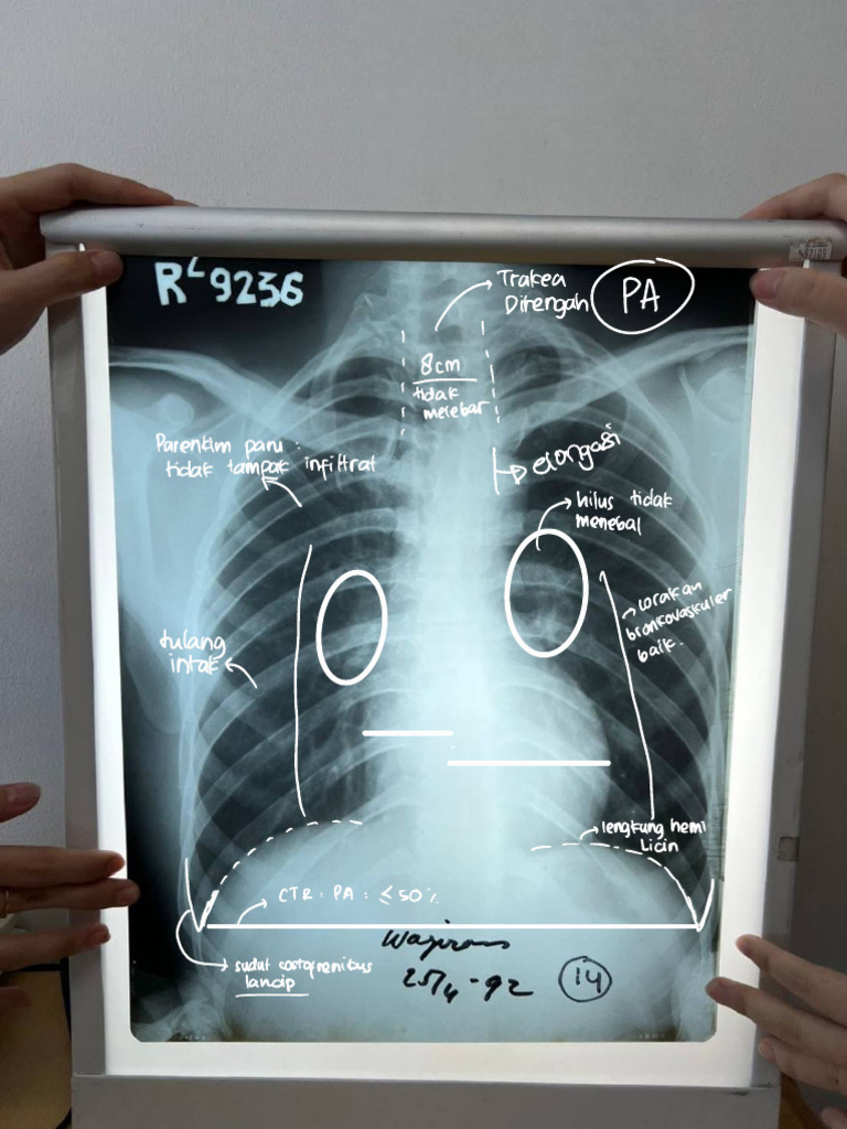 Foto Thorax | PDF