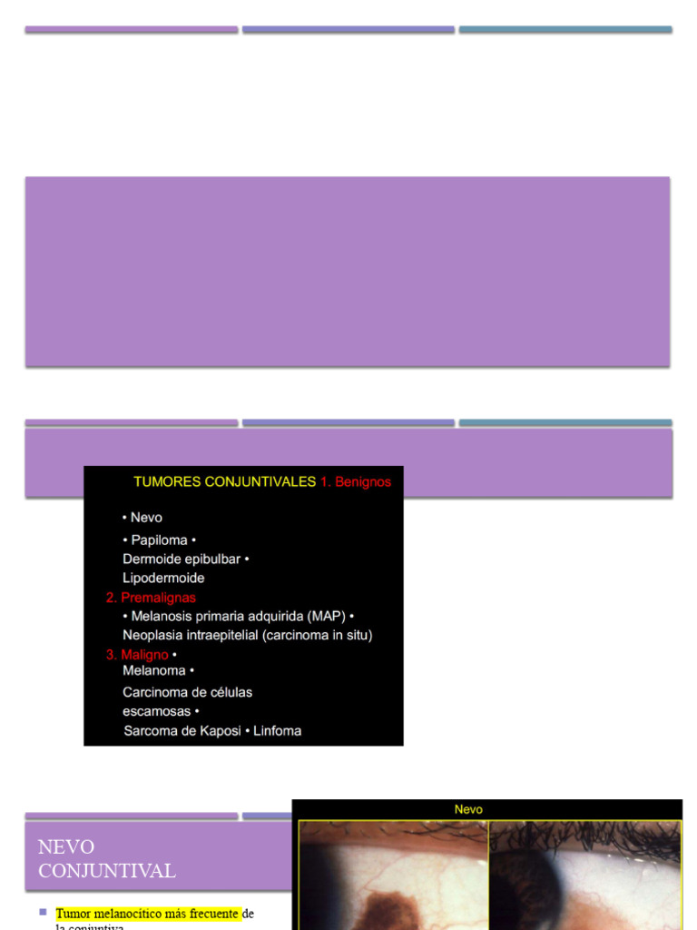 TUMORES CONJUNTIVA Y CORNEA | PDF | Cáncer | Epitelio