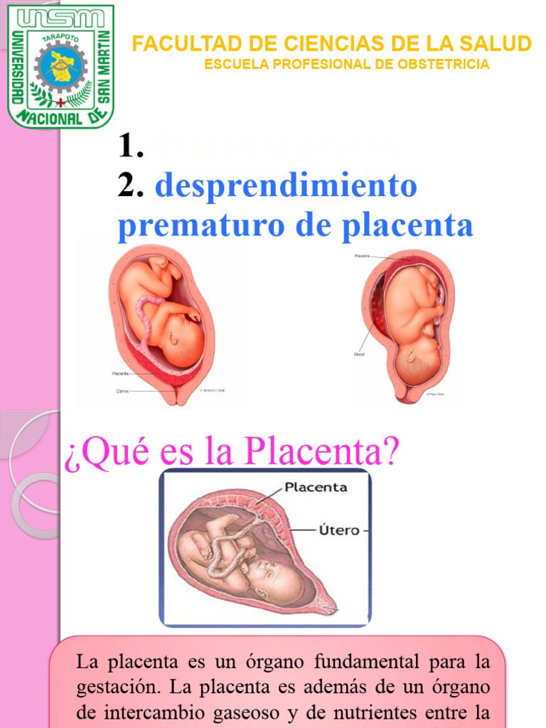 placenta-previa. obstetricia | PDF | Placenta | El embarazo