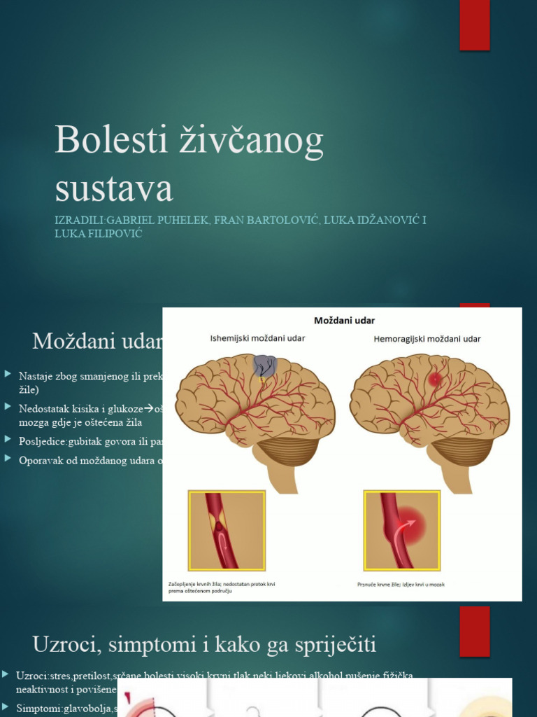 Bolesti Živčanog Sustava | PDF