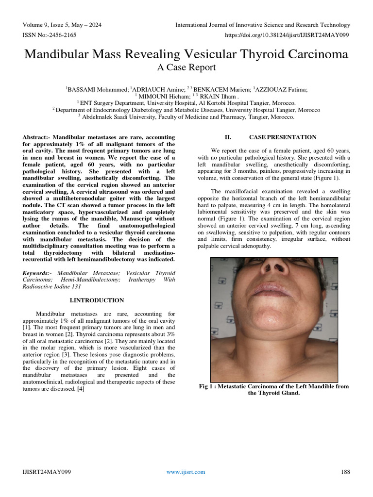 Mandibular Mass Revealing Vesicular Thyroid Carcinoma A Case Report ...