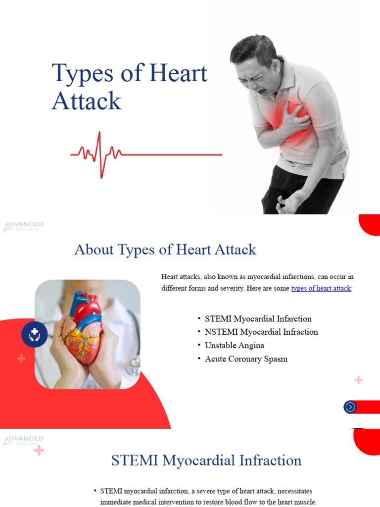 What Are The Types of Heart Attack | PDF | Myocardial Infarction ...