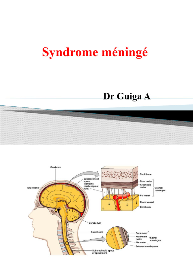 Signes et symptômes du syndrome méningé | PDF
