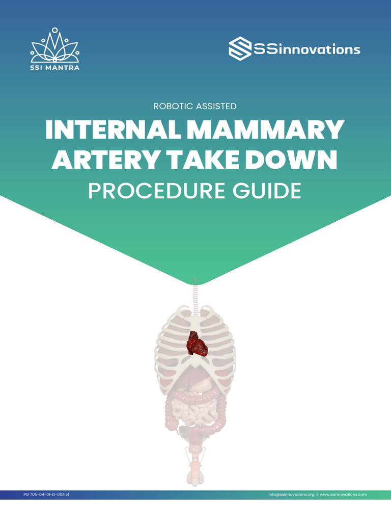 TECAB - SSi Procedure Guide v3 2 | PDF | Coronary Artery Bypass Surgery ...