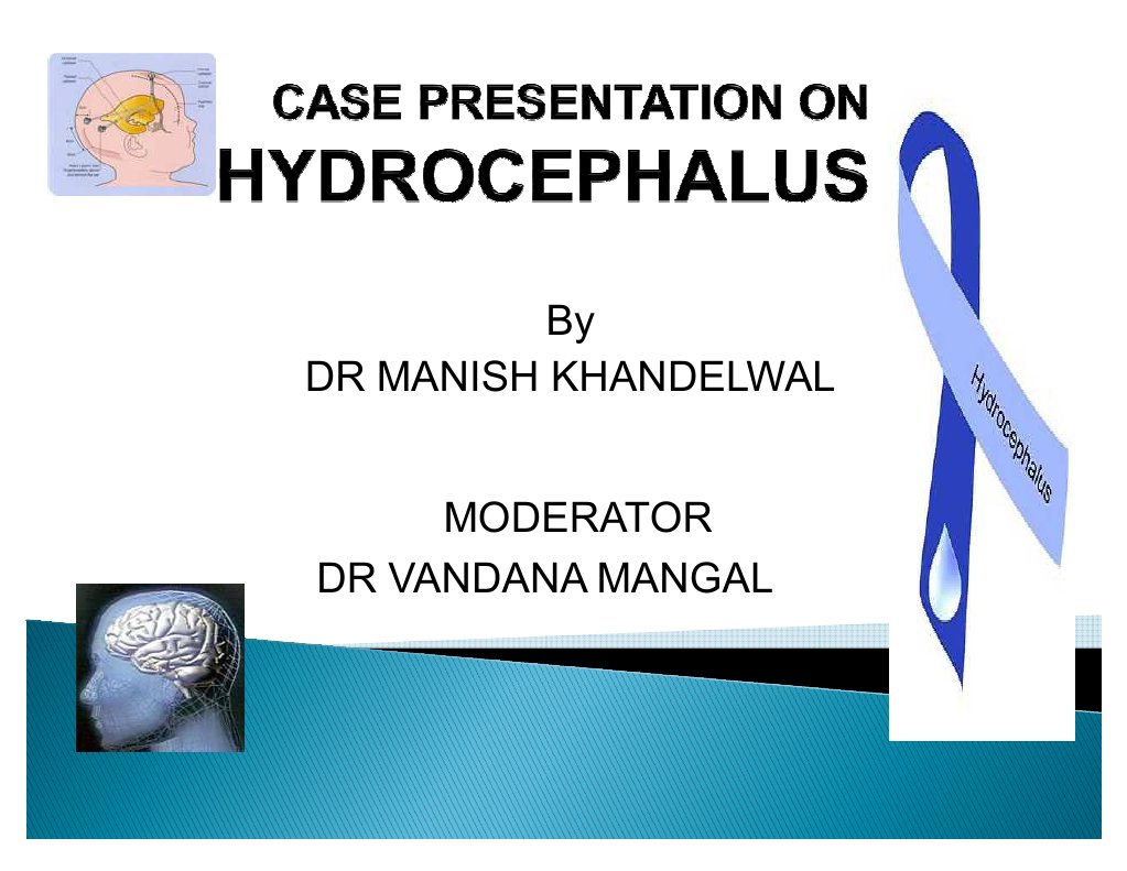 Ppt Hydrocephalus | Cerebrospinal Fluid | Anesthesia