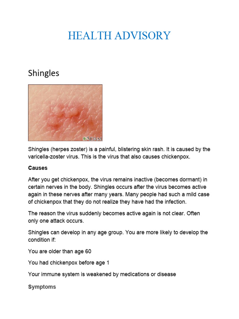 Shingles | Download Free PDF | Diseases And Disorders | Public Health