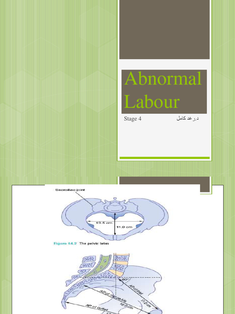 Abnormal Labour | PDF | Pelvis | Childbirth