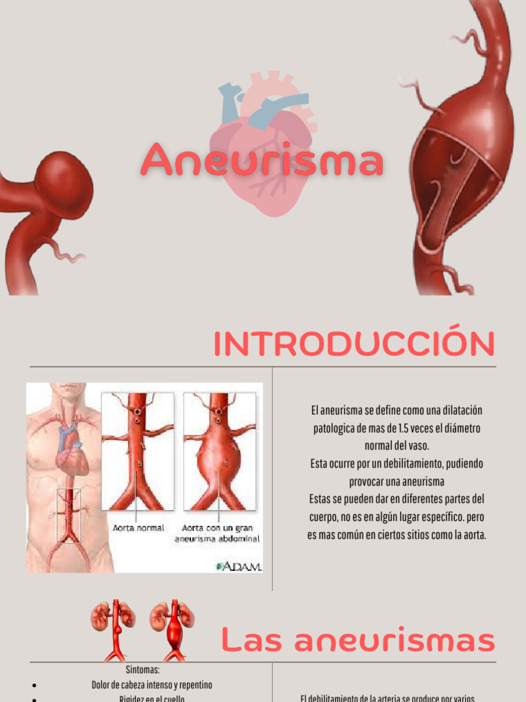 Aneurisma | Descargar gratis PDF | Medicina CLINICA | Enfermedades y trastornos