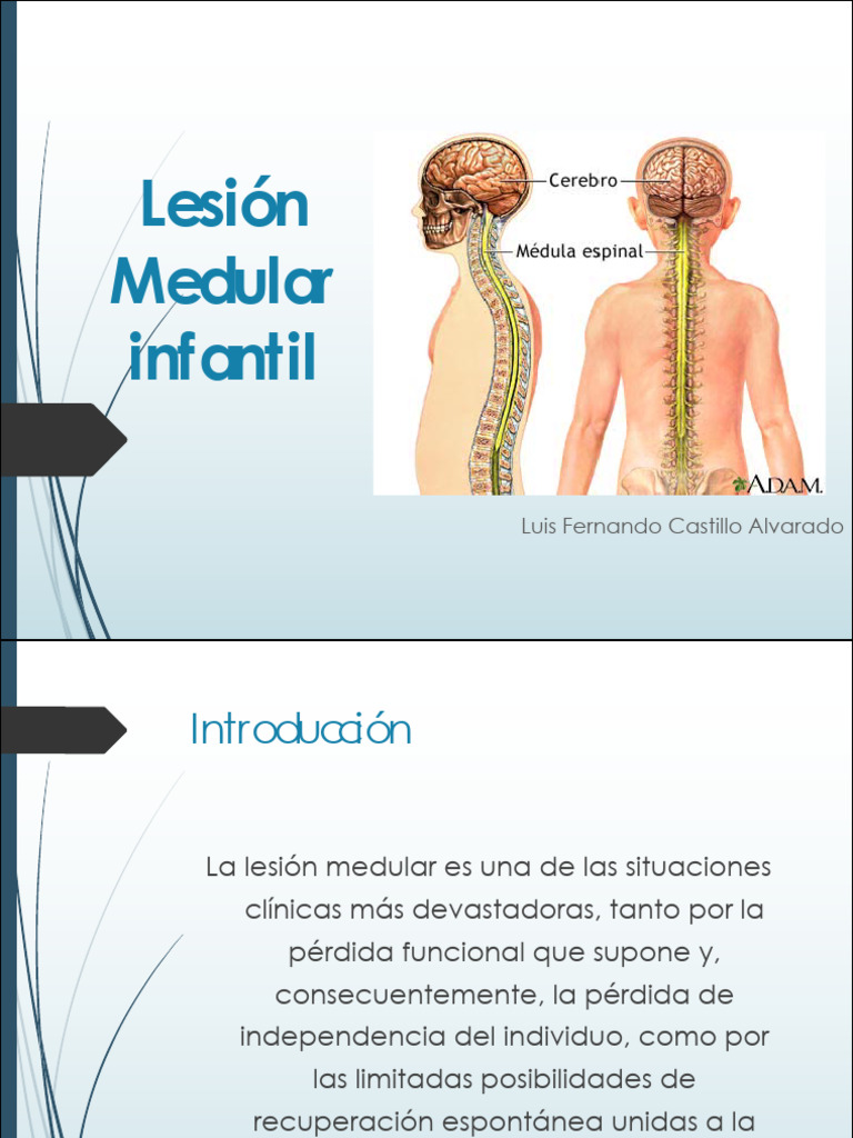 Lesión Medular Infantil | Descargar gratis PDF | Lesión de la médula ...