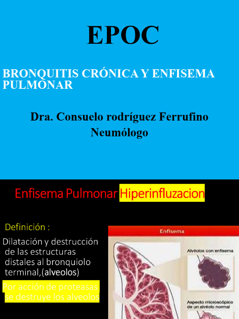 EPOC: Enfisema y Bronquitis Crónica | PDF | Enfermedad pulmonar ...