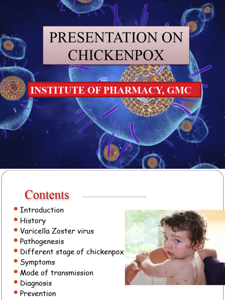 Chickenpox | PDF | Causes Of Death | Animal Viral Diseases