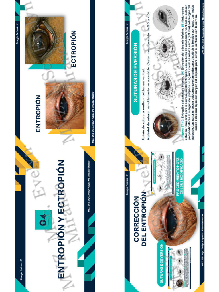 Entropion y Ectropion | PDF