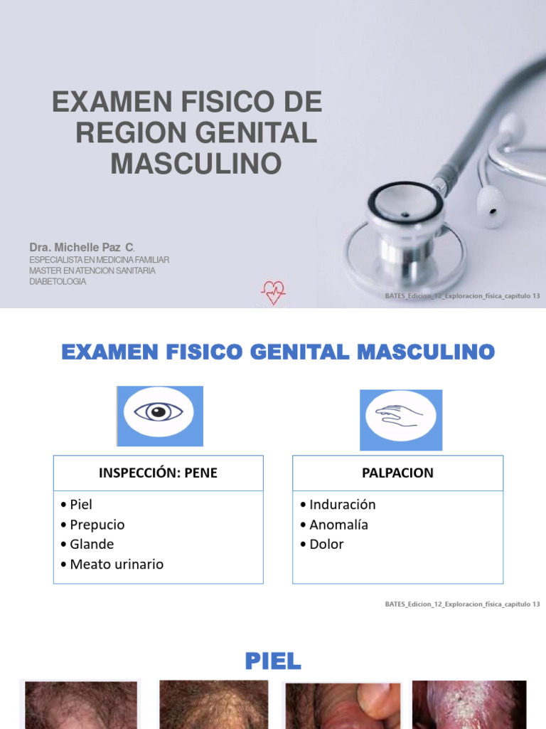 Examen Fisico de Region Genital Masculina | Descargar gratis PDF | Insuficiencia cardíaca ...