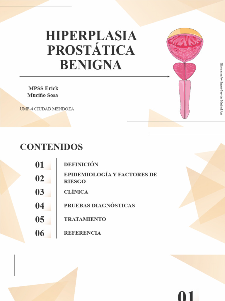 Hiperplasia Prostática: Diagnóstico y Tratamiento | PDF ...