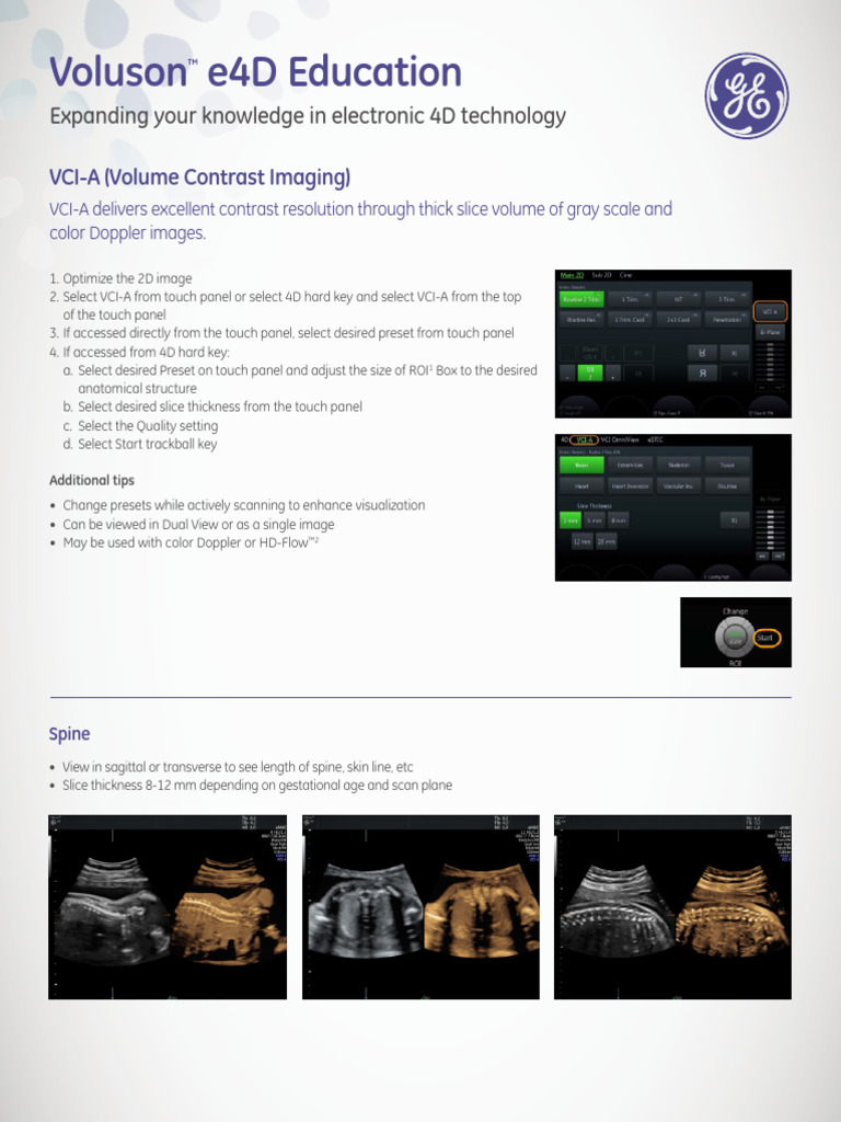 voluson-e4d-quick-card-using-vci-a-2016 | PDF | Touchscreen