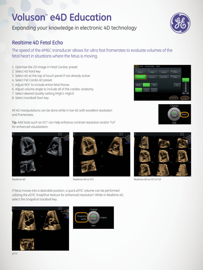 Voluson E4d Quick Card Using Realtime 4d For Fetal Echo 2016 | PDF | Medical Ultrasound ...