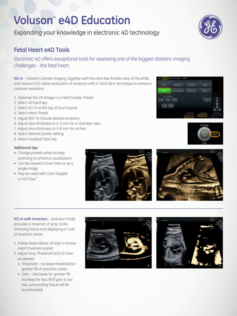 Voluson E4d Quick Card Fetal Heart Imaging 2016 | PDF | Heart | Medical ...
