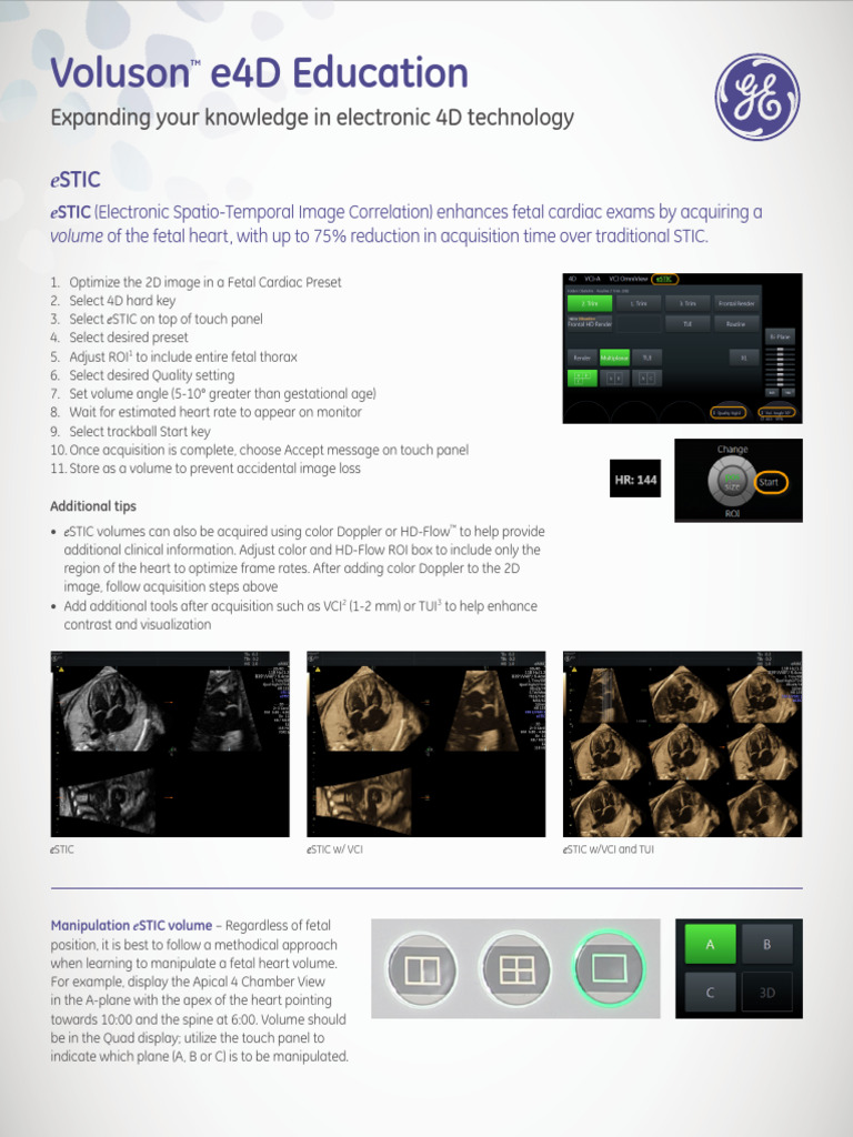 Voluson E4d Estic Quick Card 2020 | PDF | Heart | Aorta