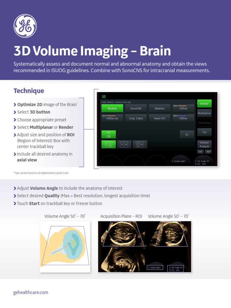 3d Volume Brain Quick Card Voluson 2020 | PDF | Imaging