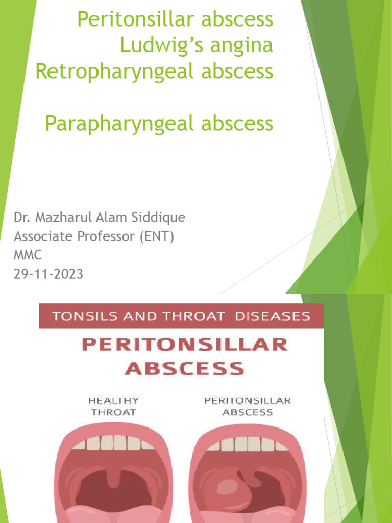 Abscess, Lud Wig Angina | PDF | Human Head And Neck | Anatomy