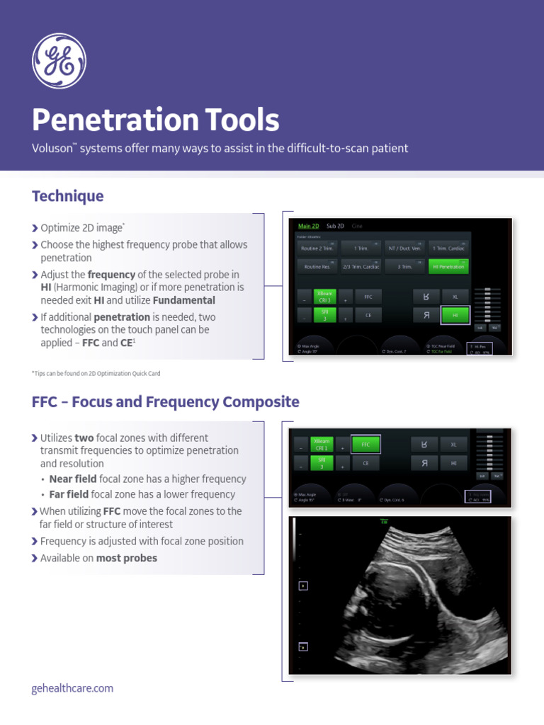 penetration-tools-quick-card-voluson-2020 | PDF